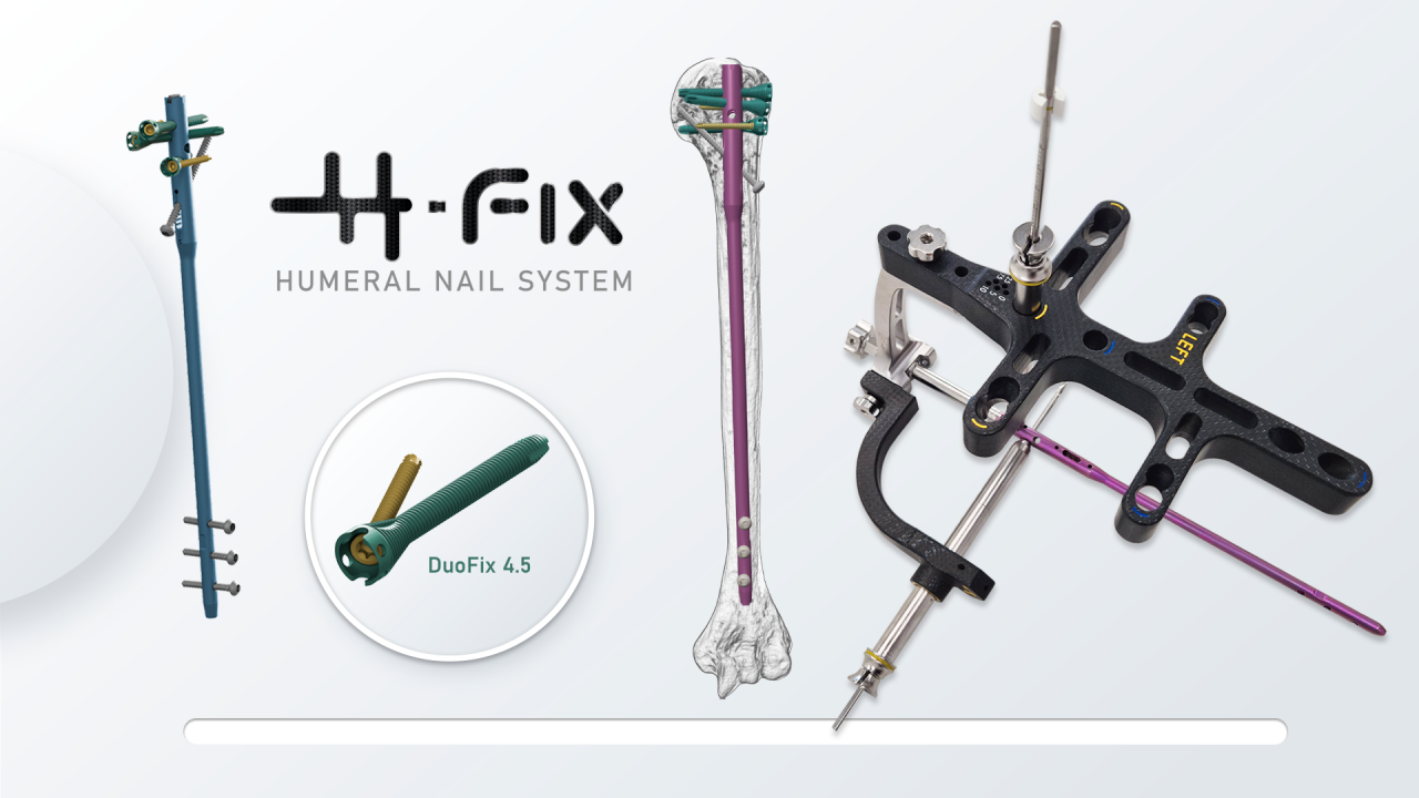 H-Fix Clavo Intramedular para Húmero - Traufix México